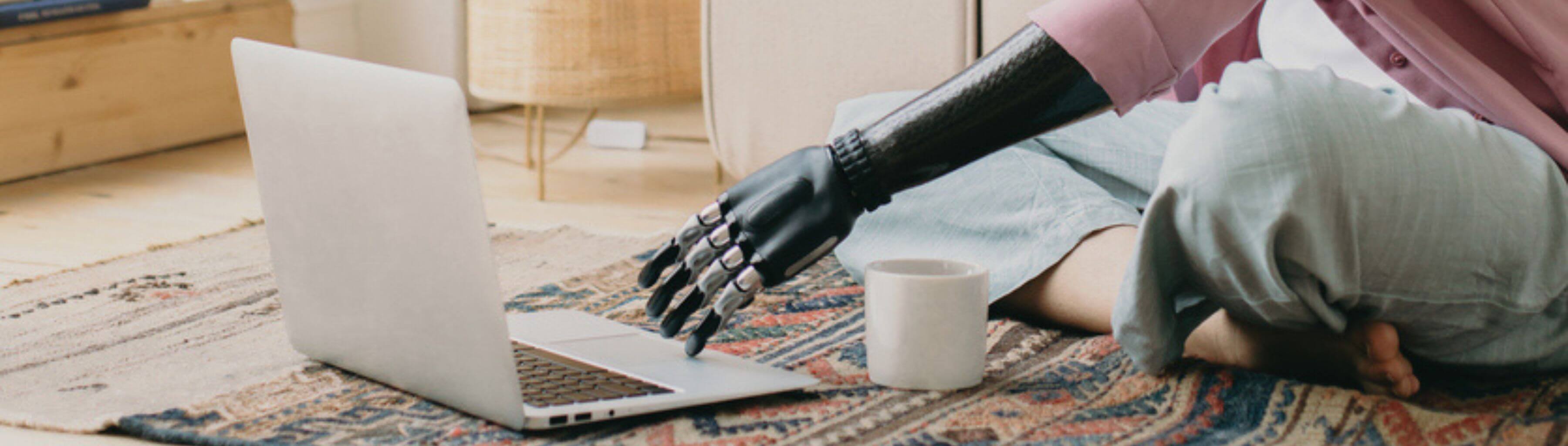 Prosthesis information & Stories - Amputee Care Center